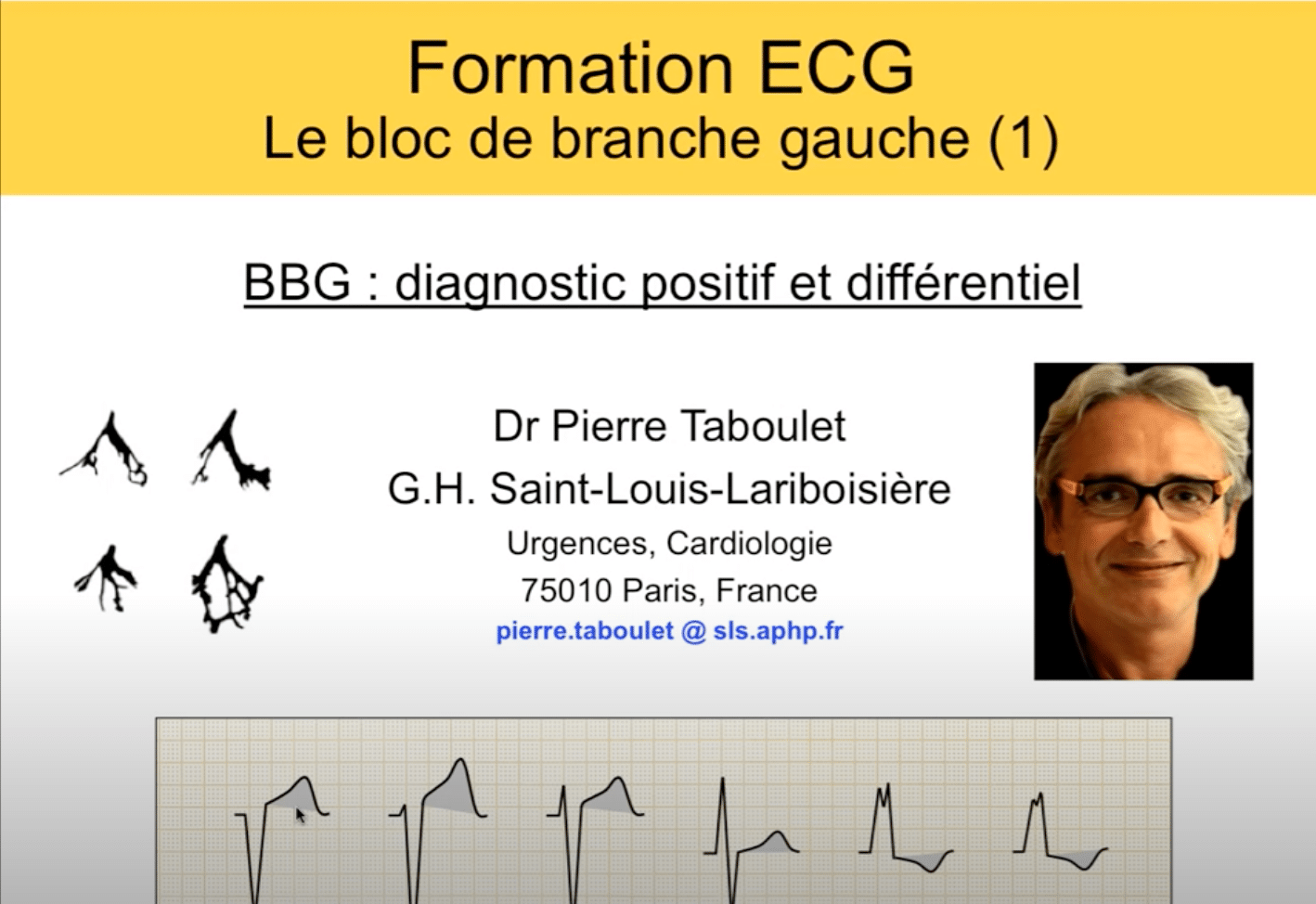 ECG -10 - Les ressources KitMédical